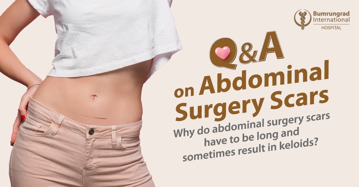 Q&A on Abdominal Surgery Scars - BookDoc